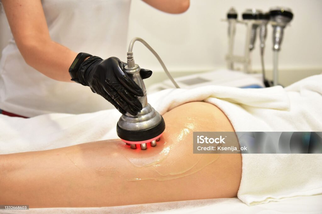 Red Light Therapy For Cellulite: Does Science Show It Works? - redlitex.com